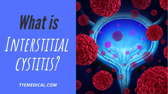 A Brief Guide to Interstitial Cystitis - TYE Medical