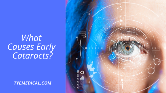 What Causes Early Cataracts? - TYE Medical