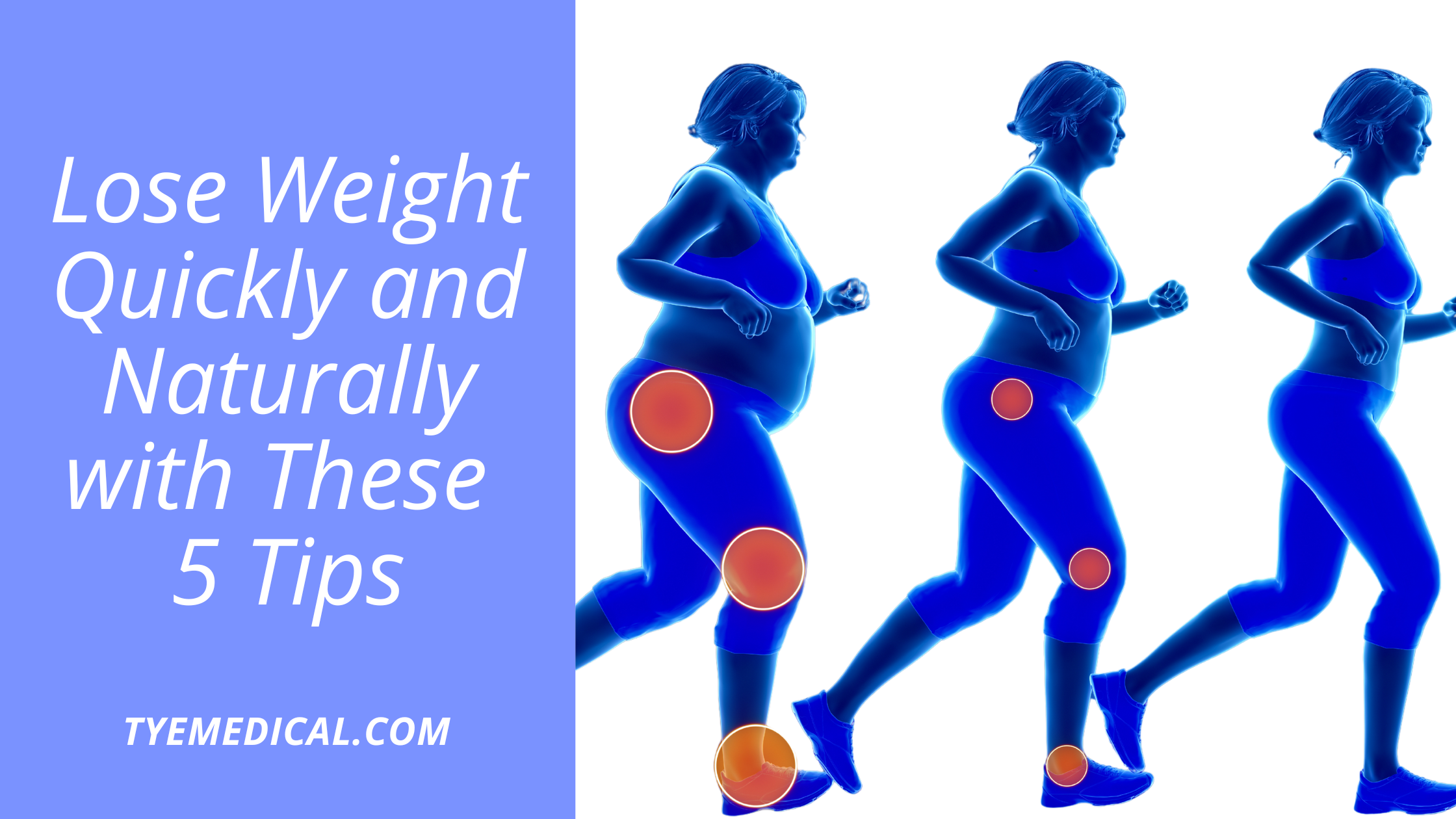 Lose Weight Quickly and Naturally with These 5 Tips - TYE Medical