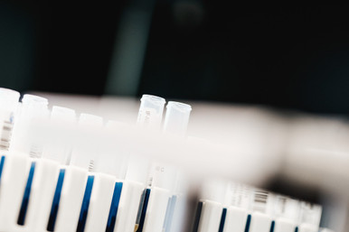 S -Testosteroni - SYNLAB Suomi