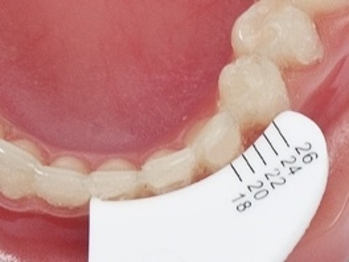 Reliance Extend Measuring Device - White Oak Orthodontic Products