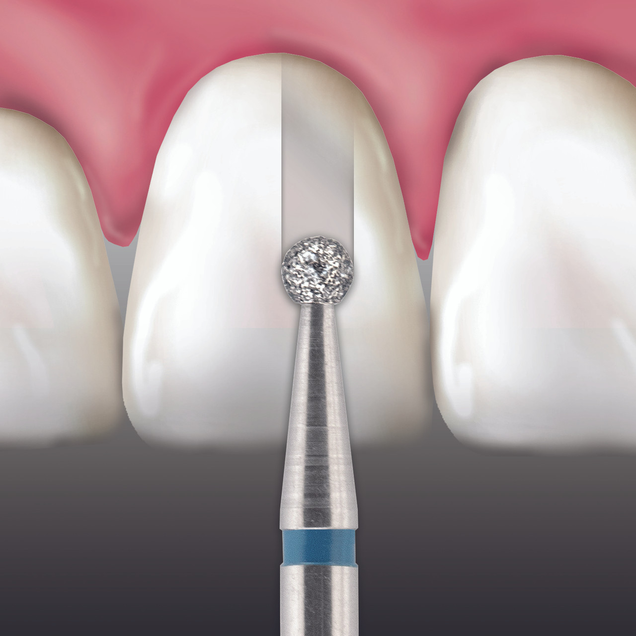 801 Diamond Bur Round (HP)