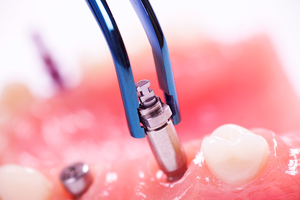 Luxator RootPicker Angled