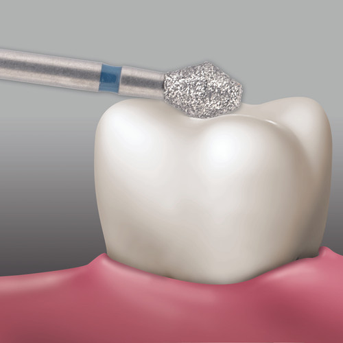 811LH Diamond Bur Double cone, barrel (FG)