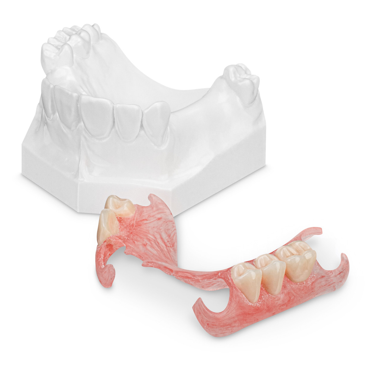Flexible Upper Partial Denture Model – Patient Education Tool