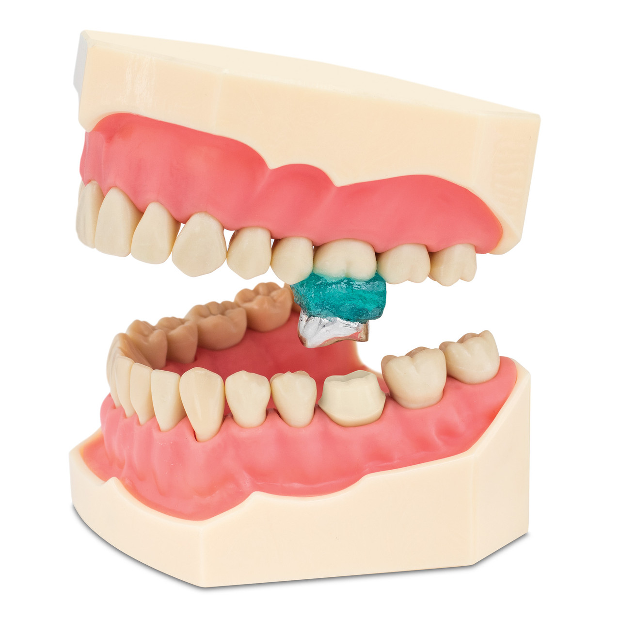 Richwil Crown and Bridge Removers 25/Box | Practicon Inc