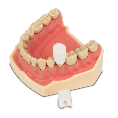 Size 3 Medium Retraction Caps 120/Pack | Practicon Inc