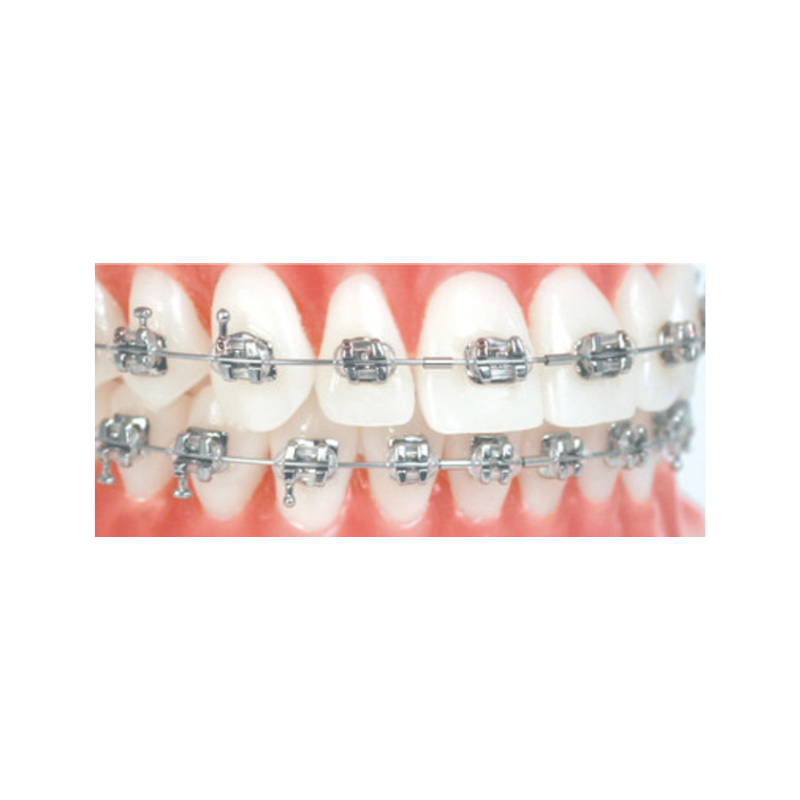 Mini Stops crimpables (25 un) - Dental de Venta Directa SA (DVD ...