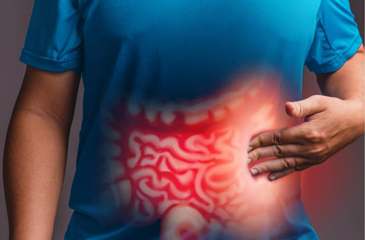 Digestive Problems And How To Manage Them - Kapiva