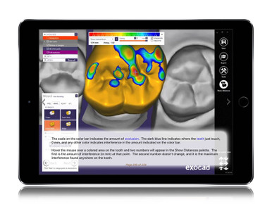 PTC exocad Training - Blue Dolphin Products