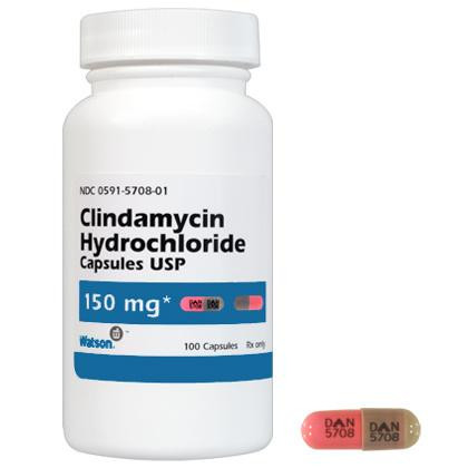 Clindamycin Capsules 150mg 100/Bt - Pricenex