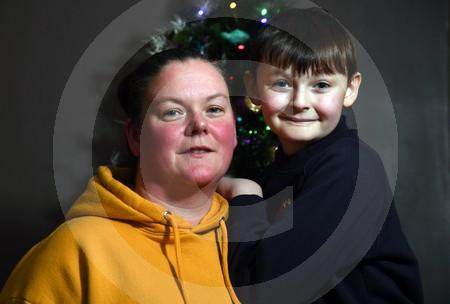 39301329-Ellis Artist, then six, was struck down with a rare condition ...