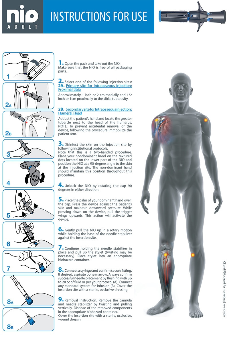 NIO Intraosseous Devices - Adult