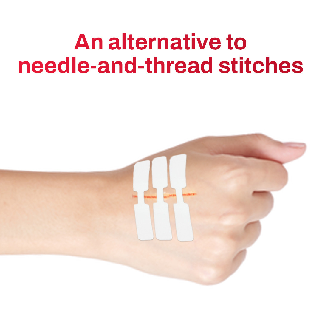 Ever Ready First Aid Sterile Butterfly Wound Closure (Large), Box of 100