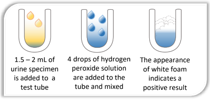 Rapid Test Kit Accutest® Uriscreen™ Urinalysis Urinary Tract Infection ...