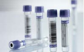 Greiner Vacuette, Serum Clot Activator Venous Blood Collection Tube ...