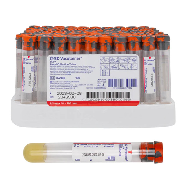 Bd Vacutainer Tubes Plastic Tube Bd Vacutainer™ Urine Collection Kits Urinalysis Box 100