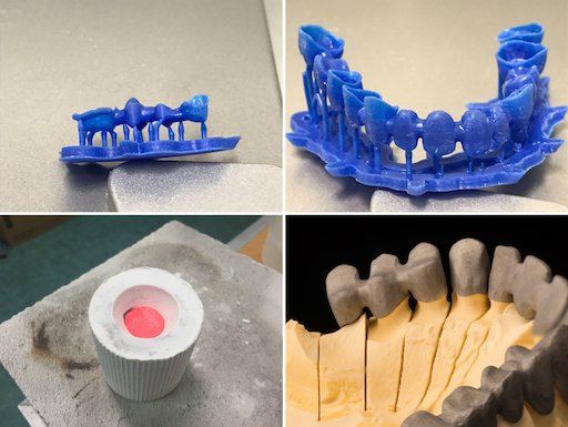 Cast or press 3D printed patterns with Z4 - Vacalon