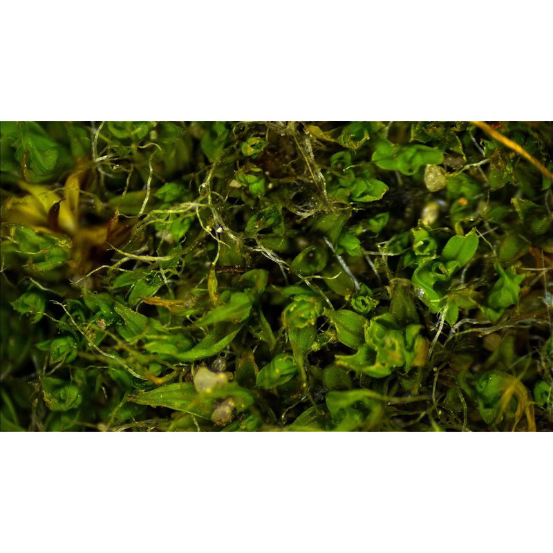 Steindorff HD Digital Video Microscope with 12" LCD Display & Measuring ...