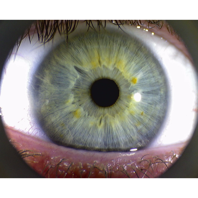 Firefly DE400 Digital Iris Scope - New York Microscope Company