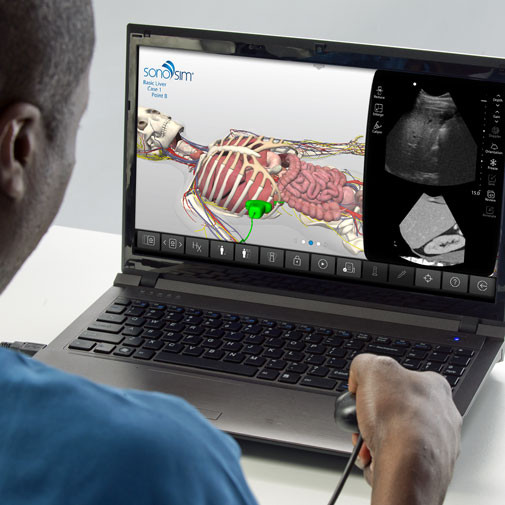 Liver Ultrasound Training - Liver Anatomy