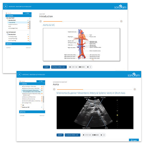Ultrasound Training - Inferior Vena Cava (IVC) and Aorta Anatomy