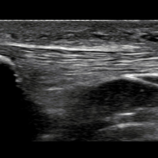 Soft Tissue Ultrasound - Clinical Ultrasound Training for Soft Tissue