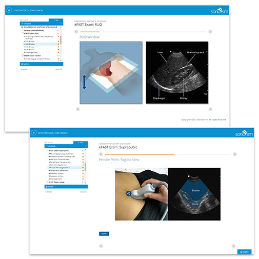 Clinical Ultrasound Training - eFAST Ultrasound Exam