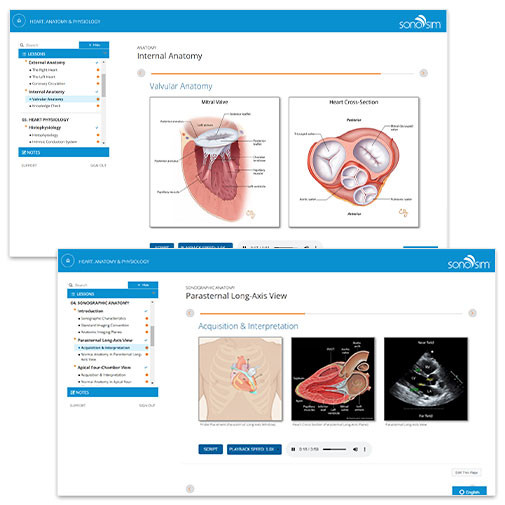 Cardiac Ultrasound Training - Heart Ultrasound, Cardiology Ultrasound