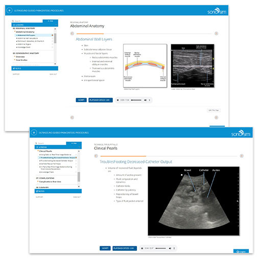 Paracentesis Procedure Training - Ultrasound-Guided Technique