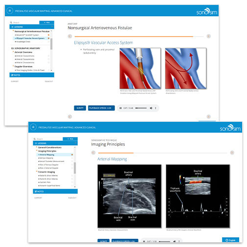 Vascular Mapping Dialysis Access Ultrasound Training