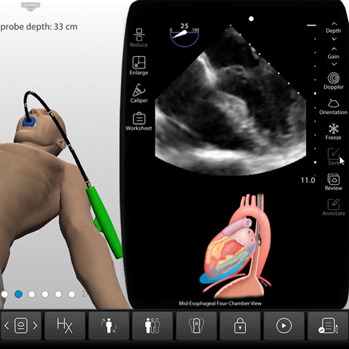 Transesophageal Echocardiogram TEE - Resuscitative TEE Ultrasound Training
