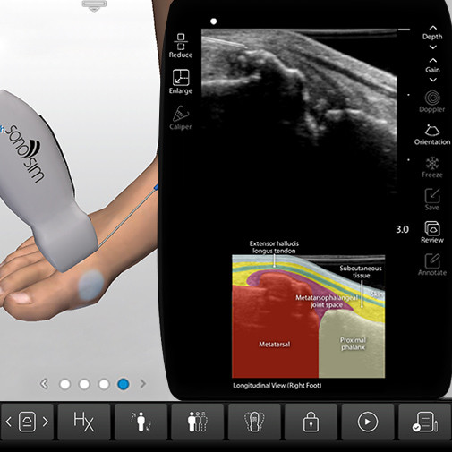 Ultrasound Training - Metatarsophalangeal Joint Injection Procedure