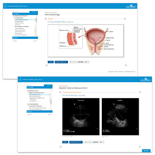 Ultrasound Training - Bladder, Urinary Catheters