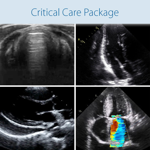 RUSH Protocol Training - Rapid Ultrasound in Shock Protocol