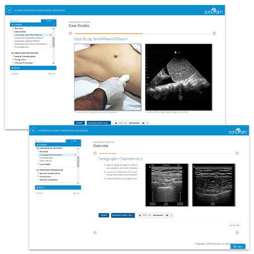 Thoracentesis Procedure - Ultrasound Guided Technique Training
