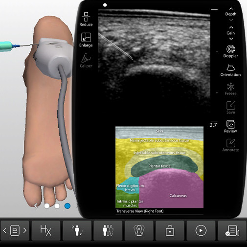 Plantar Fascia Ultrasound-Guided Injections Procedure Module