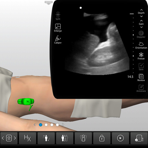 Ultrasound Training - FAST Ultrasound