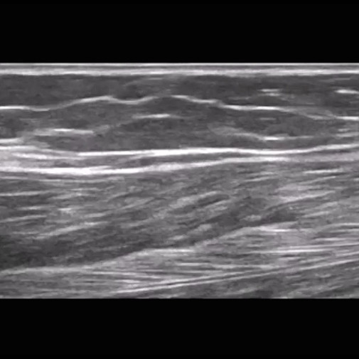 Soft Tissue Ultrasound - Clinical Ultrasound Training for Soft Tissue