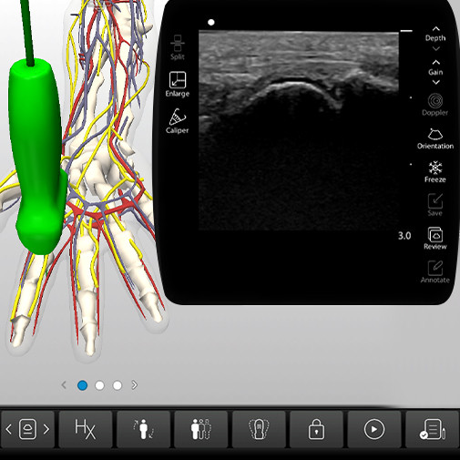 Ultrasound Hand - Ultrasound Finger - Training
