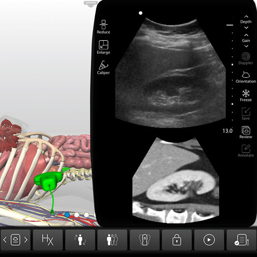 Clinical Ultrasound Training - eFAST Ultrasound Exam
