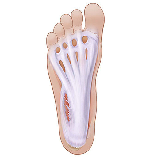 Plantar Fascia Ultrasound-Guided Injections Procedure Module