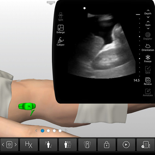 Ultrasound Training - FAST Ultrasound