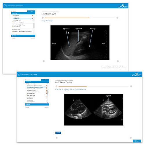 Ultrasound Training - FAST Ultrasound