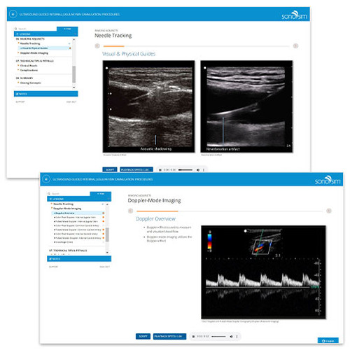 Internal Jugular Vein - Ultrasound Guided Cannulation