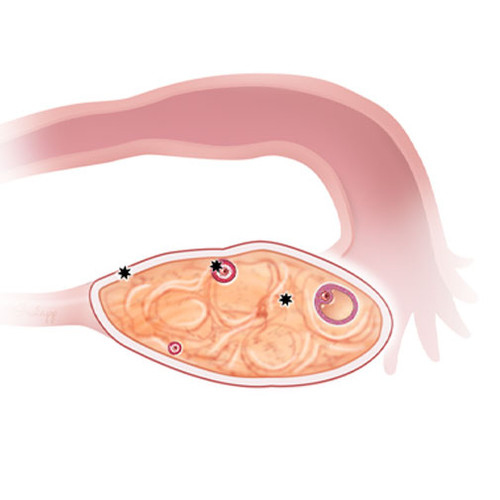 Clinical Normal Adnexa Ultrasound Training