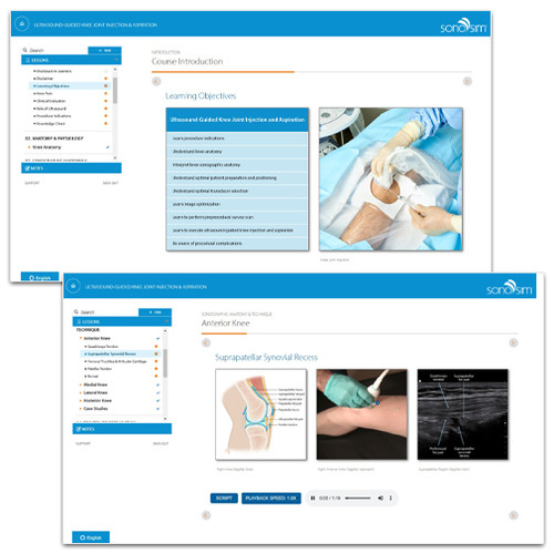 Ultrasound Training - Knee Injection and Aspiration Procedure
