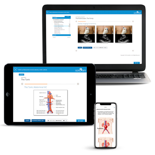 RUSH Protocol Training - Rapid Ultrasound in Shock Protocol