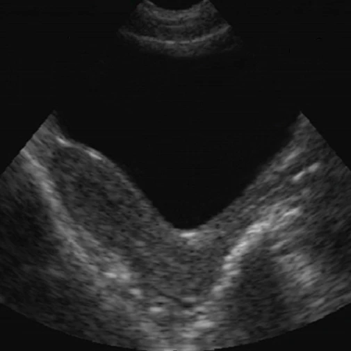 Female Pelvis Ultrasound Training - Anatomy & Physiology