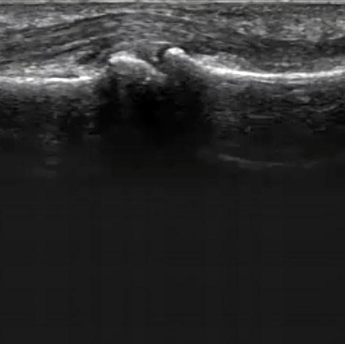 Soft Tissue Ultrasound - Anatomy & Physiology Training